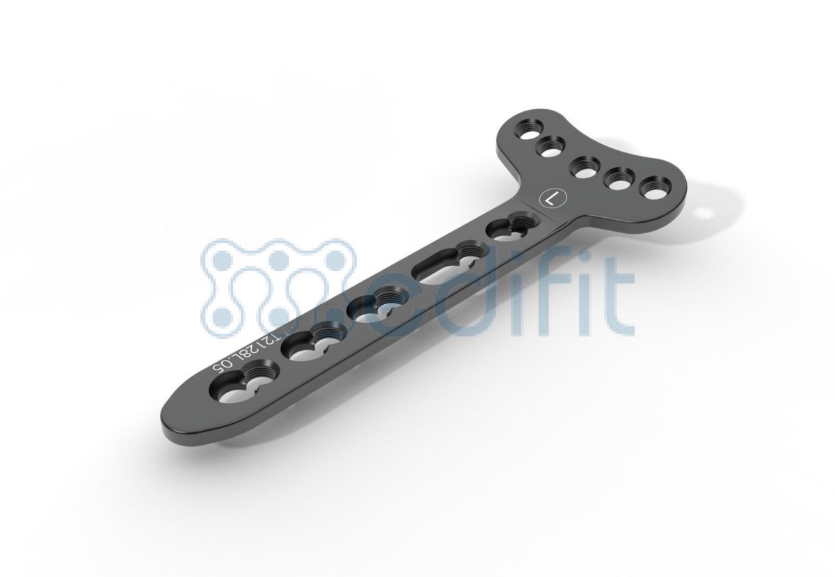 VOLAR DISTAL RADIUS EXTRA-ARTICULAR LOCKING PLATE 2.7MM HEAD 5 HOLE ...